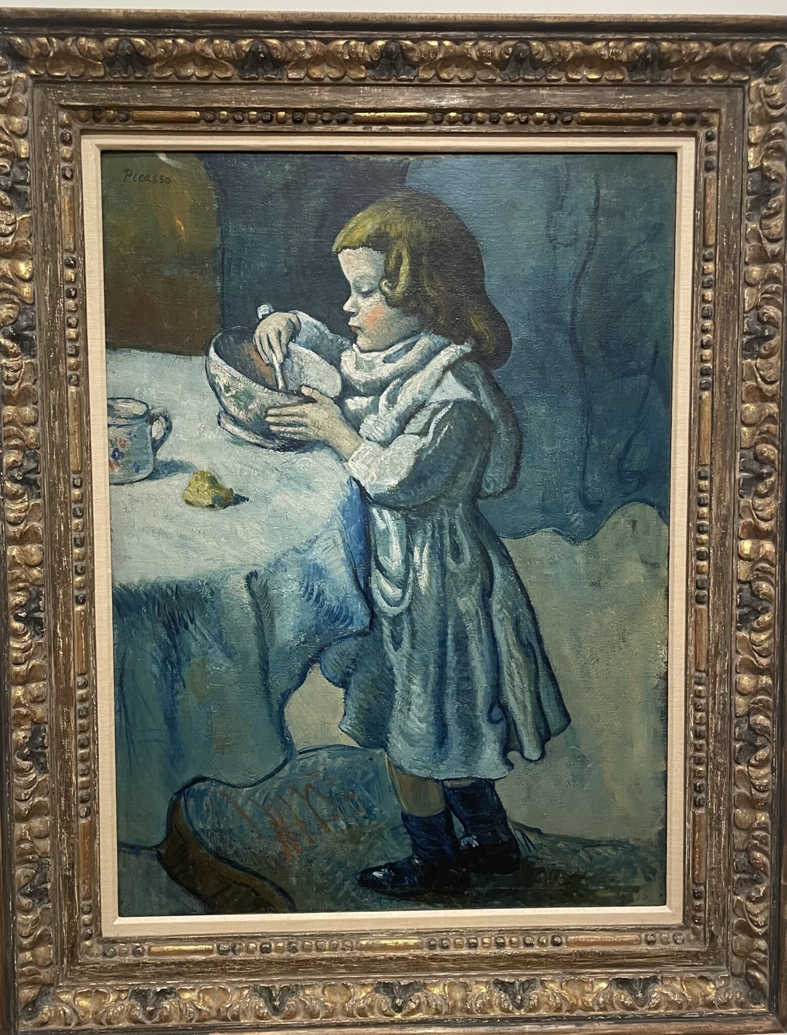 Picasso and Elbows - Dr. Matthew DiPaola